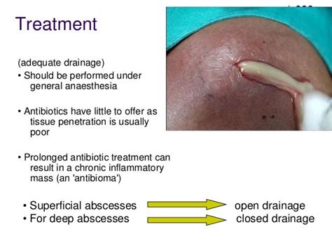 Surgerysurgical Infections 1 2