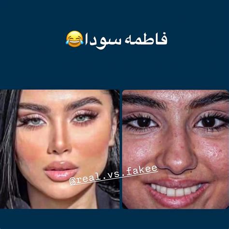 ‎بازیگران ، بلاگر ها ، جراحی زیبایی‎ ‎تازه اون یکیم ادیت شده ببین