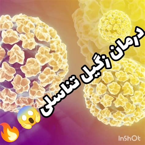 تبخال تناسلی