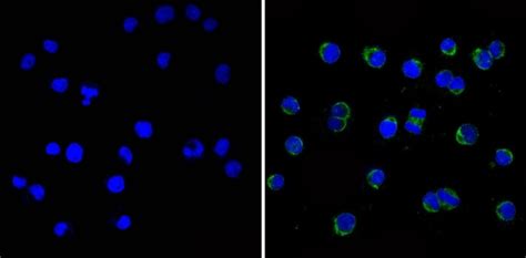 Cdk5 Antibody Ahz0492