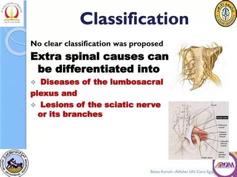 Extra Spinal Causes Of Sciatica And A Causes Algorithm Ppt