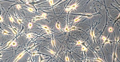 Neuronal Mesenchymal Stem Cells