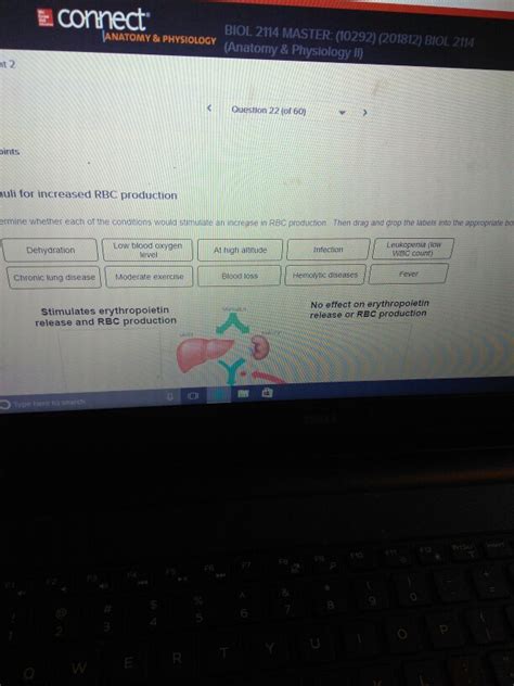 Solved Determine Weather Each Condition Would Stimilate An Chegg Com