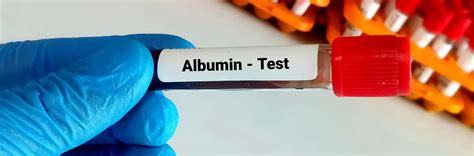 Albuminuria Causes Symptoms Treatment Albuminuria