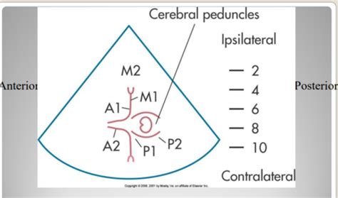 Windows Flashcards Quizlet Windows Flashcards Quizlet