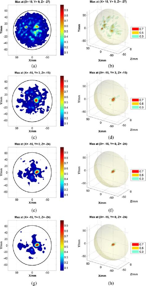 Figure 6 From Compound Radar Approach For Breast Imaging Semantic Scholar