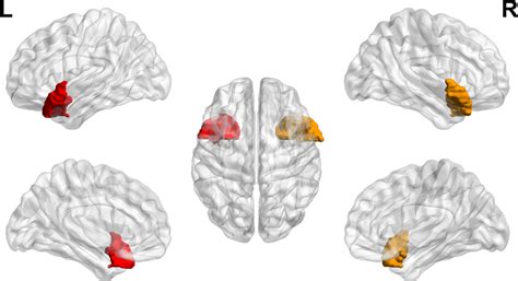 Location And Distribution Of Hyperosmotic Brain Areas In The Brain