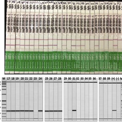 Comparison Of Reverse Transcription Recombinase Polymerase Download Scientific Diagram