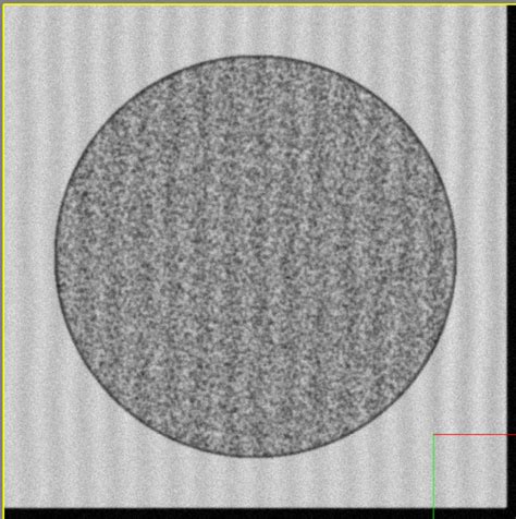 Microscope Interference Patterns Braingenix