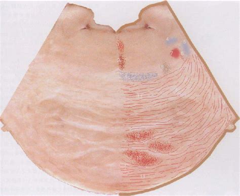 图5 1 28 经脑桥中部横切面 基础医学 医学