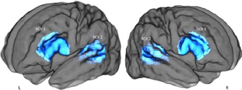 Regions Of Interest Used To Perform Anatomically Constrained Spherical