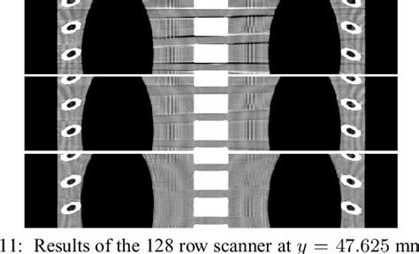 Figure 11 From Evaluation Of Helical Cone Beam Ct Reconstruction Algorithms Semantic Scholar