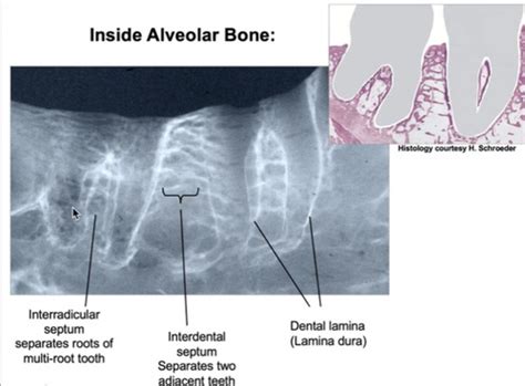 Interradicular Septum Koreamed