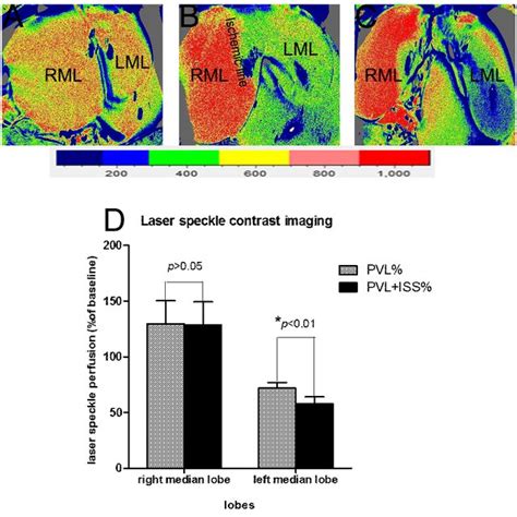Laser Speckle Contrast Imaging Lsci Typical Hepatic Flux Perfusion
