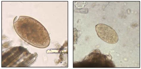 Parasitology Lecture 3 Trematode Species Flashcards Quizlet