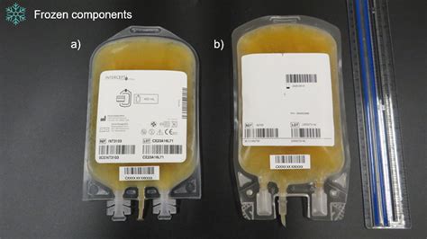 Faq Apheresis Frozen Plasma Psoralen Treated Professional Education