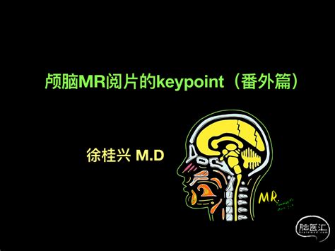 颅脑mr阅⽚的keypoint（番外篇） 脑医汇