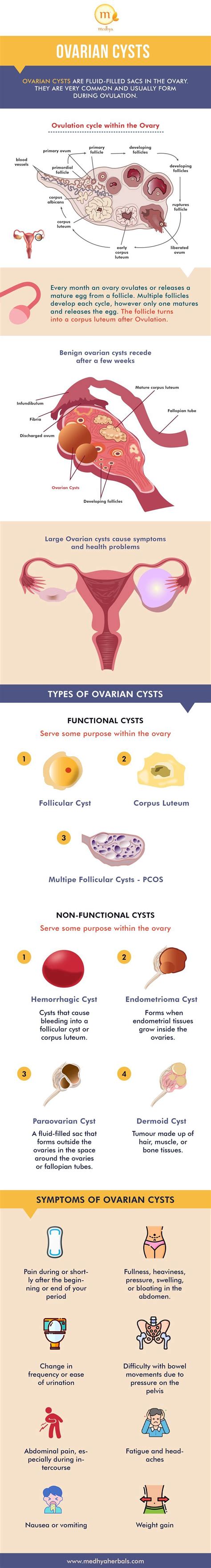 Ovarian Cyst Treatment In Ayurveda A Doctor S Guide Artofit