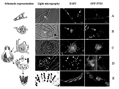Peroxisome Appearance During The Major Steps Of P Anserina Sexual