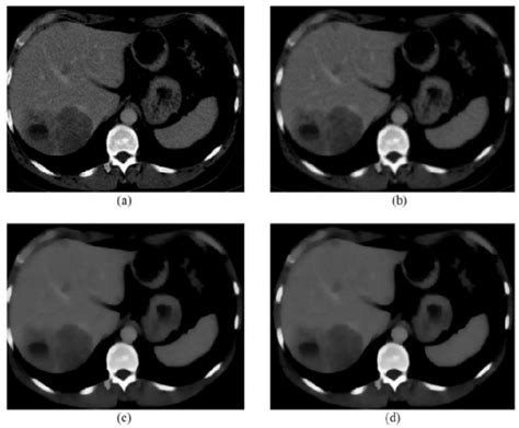 Noise Reduction From A Computer Tomography Ct Image A Input Noisy