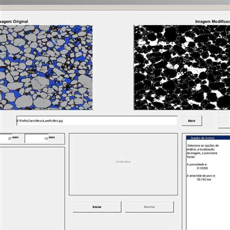 Gamma Ray Gr Log Plot Showing Api Unit Ranging From A Low Value Of Download Scientific