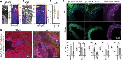 Neointima Formation Is Accompanied By Reduced Extracellular Matrix