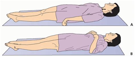 Stupor And Coma Neupsy Key