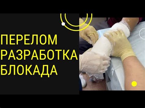 ПЕРЕЛОМ ЛУЧЕВОЙ КОСТИ| Контрактура| Блокада| Что делать после Снятия ...