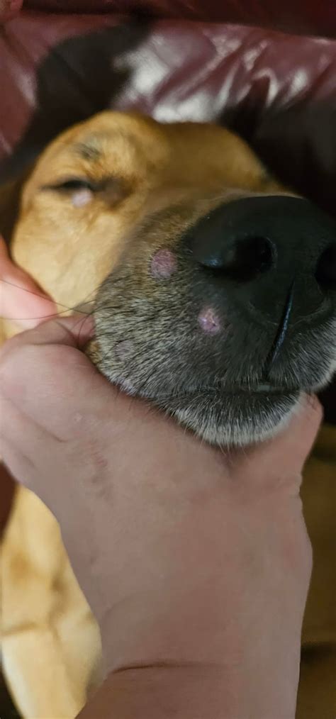 Bug Bites Ringworm Help Rbugbites