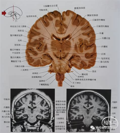 临床神经解剖图谱（断层影像切片） 脑医汇
