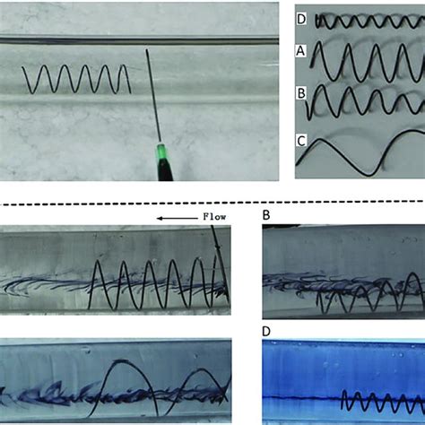 Velocity Streamlines For The Four Cases Of In Vitro Experiments I Download Scientific Diagram