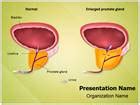 Professional Benign Prostatic Hyperplasia Editable PowerPoint Template