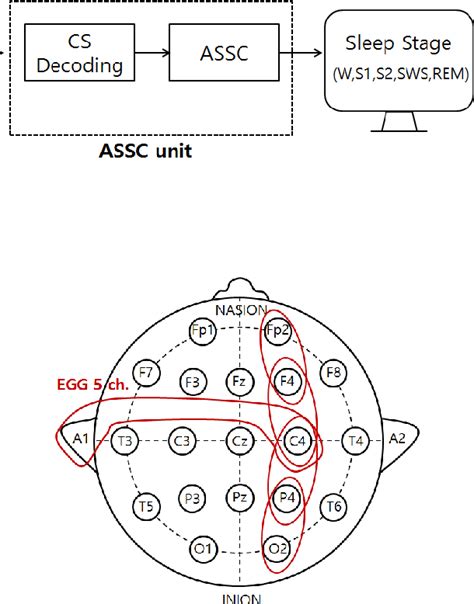 Figure 3 From A Compressive Sensing Based Automatic Sleep Stage