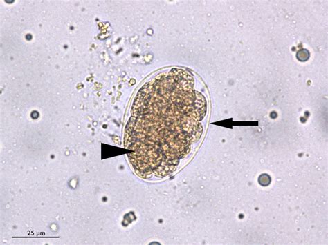 Hookworm Egg