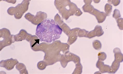 Eosinophils Cells And Smears