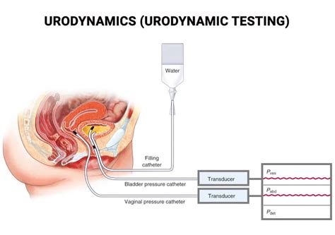 Urodynamic Testing Procedure