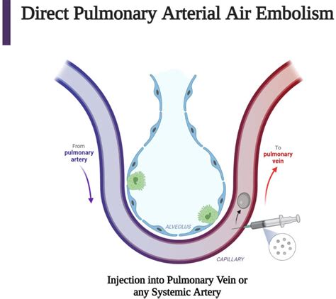 Iatrogenic Air Embolism Pathoanatomy Thromboinflammation