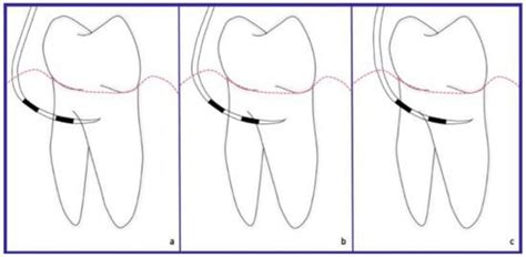 Mcq Questions And Disscussion Focus Dentistry