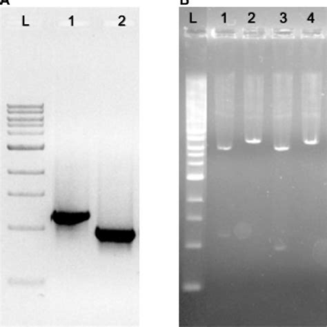 K Fab Mass Spectrum Of The Total Lipid Fraction Of Ferroplasma
