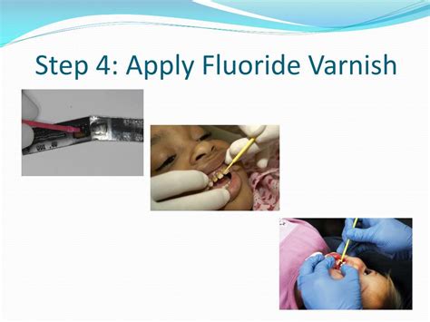 Ppt How To Apply Fluoride Varnish Powerpoint Presentation Id727603