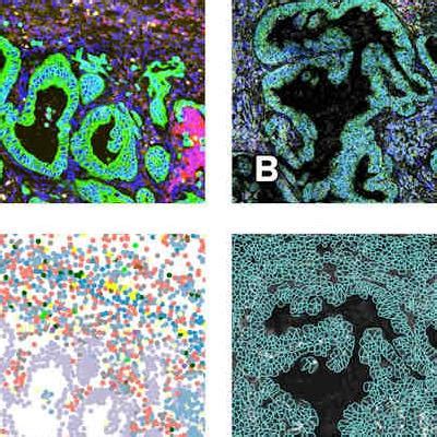 Nanostring Displays Cosmx Smi At Th Annual Spatial Genomics Summit