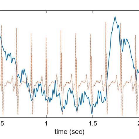 Fft Of Ecg And Ppg Signal Showing A Hr Of 625 Hz 375 Bpm The Ppg Download Scientific