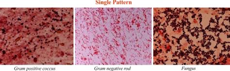 Pattern Classification From Fecal Gram Stain In The Single Pattern