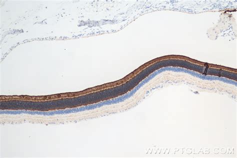 Prph2 Antibody 85043 1 Rr Proteintech 武汉三鹰生物技术有限公司