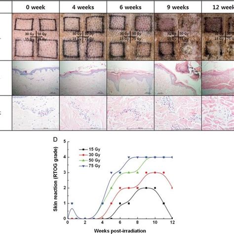 Radiation Therapy Oncology Group Toxicity Grading Download Table