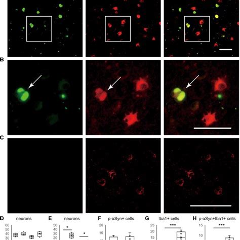 P‐αsyn Aggregate‐positive Microglia And Neurons In Brain Autopsy Download Scientific Diagram