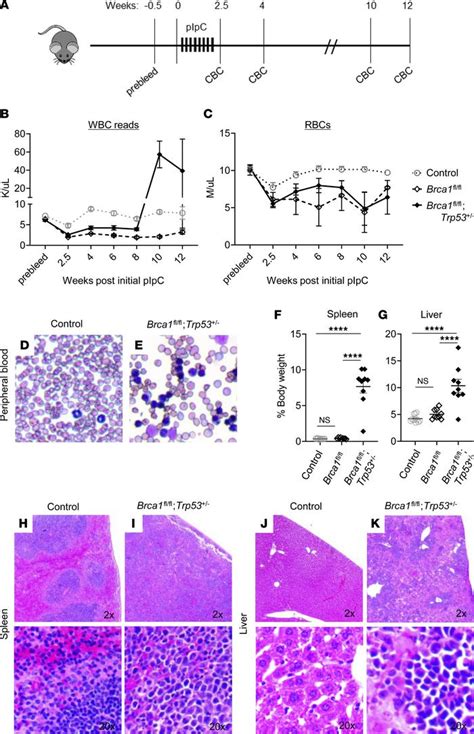 Jci Insight Brca1 And Tp53 Codeficiency Causes A Parp Inhibitor