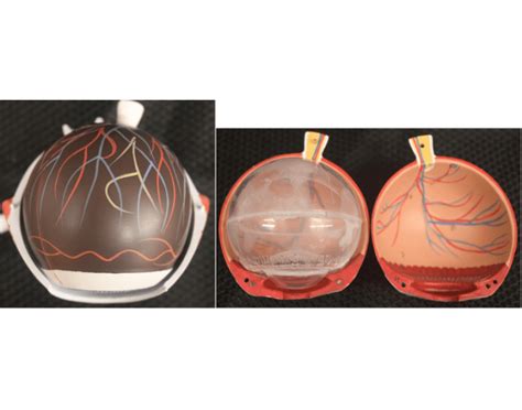 Visual System 2 Quiz