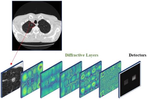 life free full text pulmonary nodule detection and classification