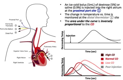 Applied Phys Preload Afterload CVP Etc Flashcards Quizlet